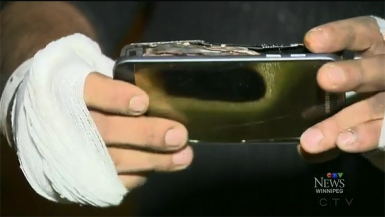 Galaxy S7繼續爆 爆到手嚴重燒傷 - winandmac.com 視麥媒體